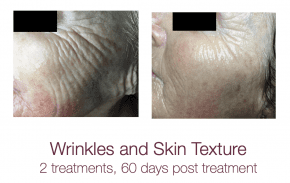 Skin Care and Med Spa Specials in Dallas